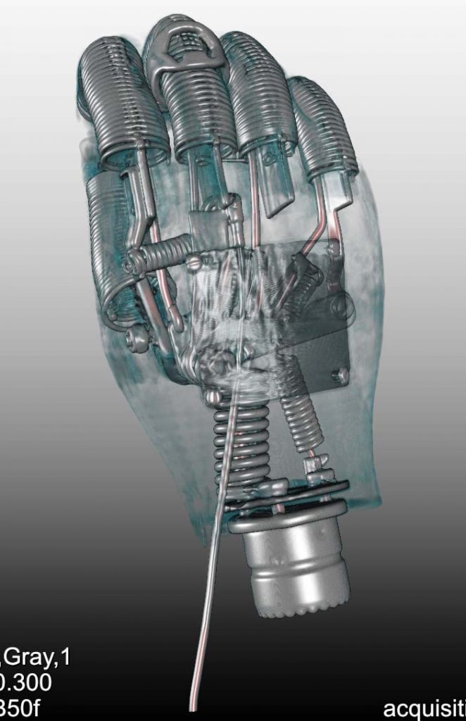 Becker Hand – best grip in town [mechanism visualization] – TECHNICAL ...