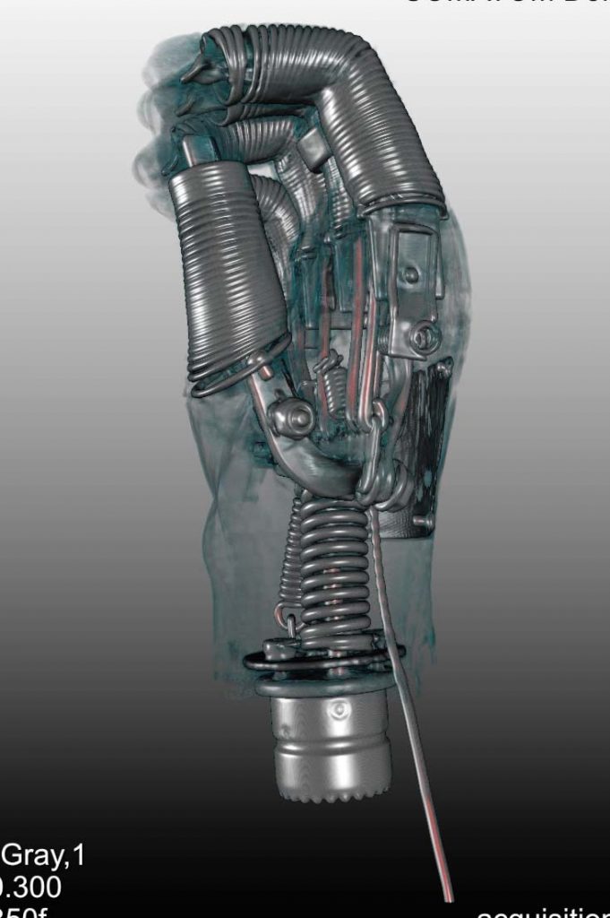 Becker Hand – best grip in town [mechanism visualization] – TECHNICAL ...