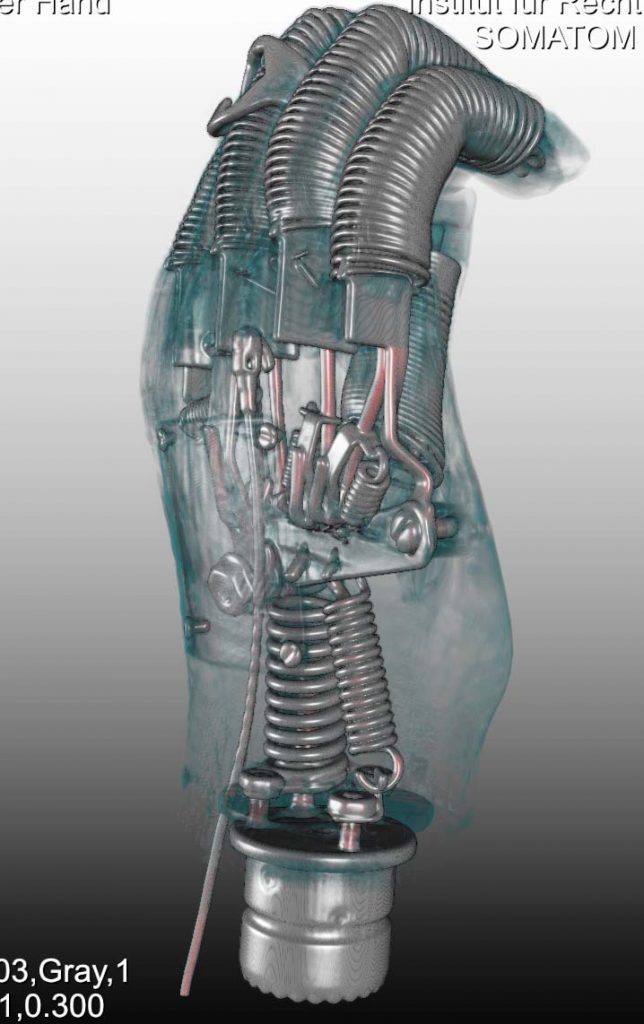 Becker Hand – best grip in town [mechanism visualization] – TECHNICAL ...
